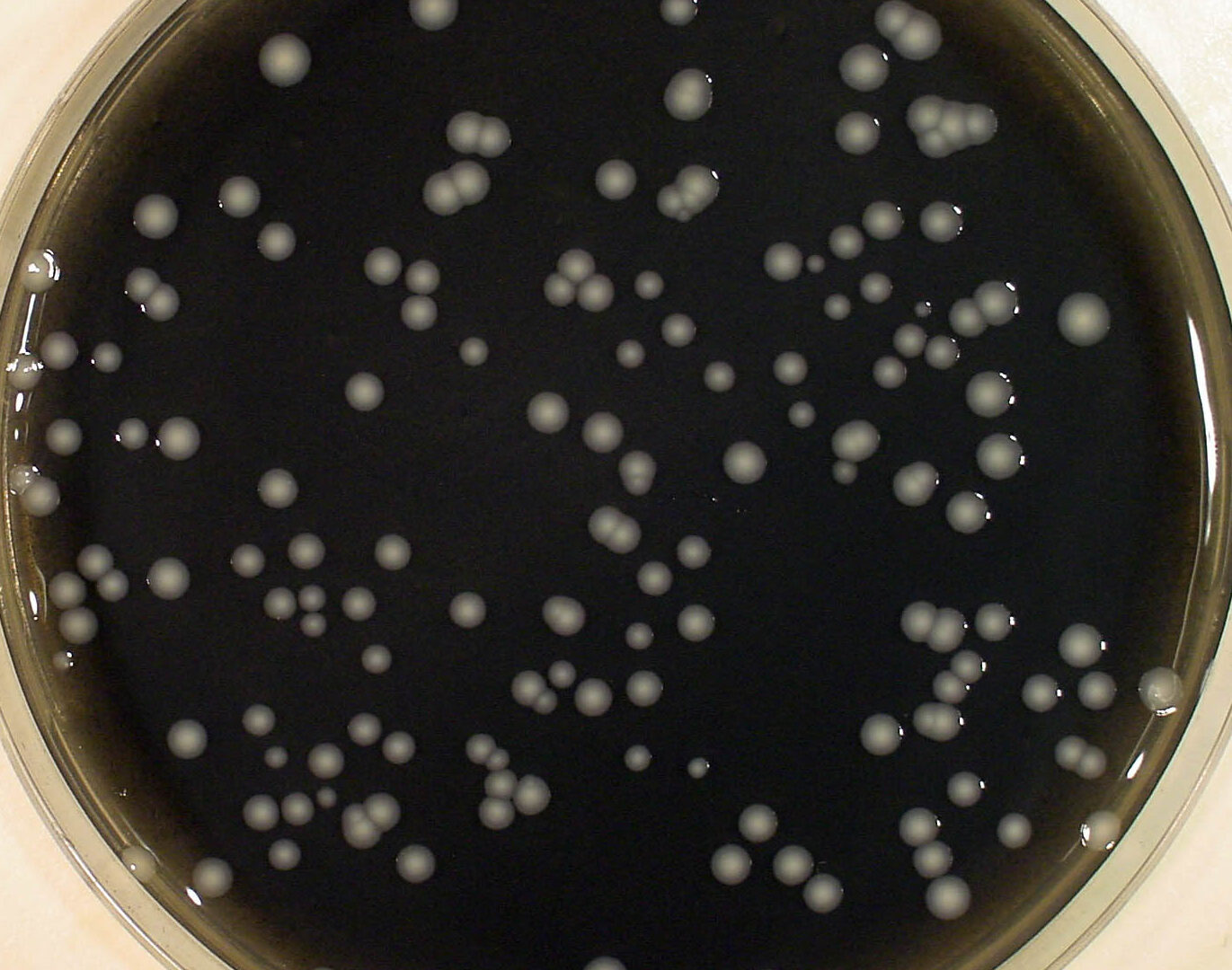 Utiliza agar Legionella GVPC: composición y aplicaciones